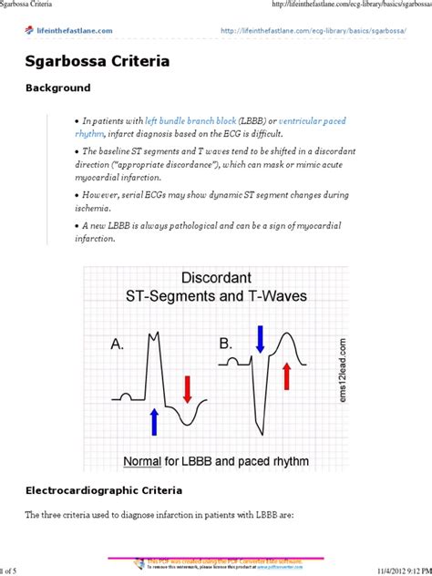 Sgarbossa Criteria Electrocardiography Myocardial Infarction