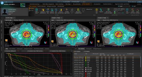 Synthetic Ct Generation In Raystation Ipem
