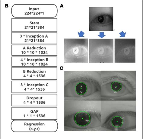 Figure 2 From A Deep Learning Model For Three Dimensional Nystagmus Detection And Its