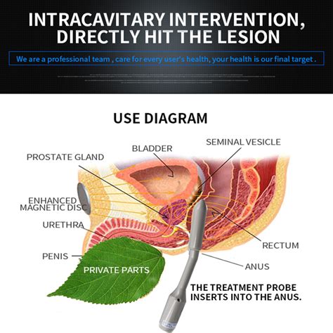 Straight Anal Sex Diagram Sex Pictures Pass