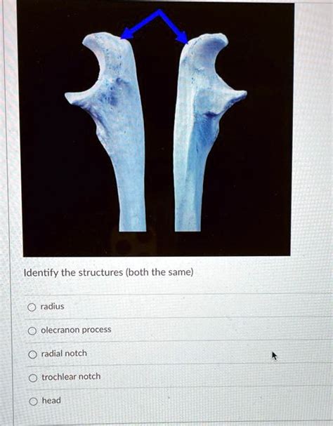 Solved 16 Identify The Structures Both The Same Radius Olecranon