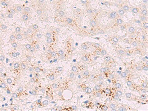 兔抗CCL 多克隆抗体 Anti CCL rabbit polyclonal antibody 生命科学产品与技术服务 生工生物工程 上海 股份有限公司
