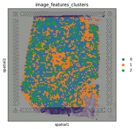Exploring Spatial Transcriptomics A Dive Into Visium Data Analysis In