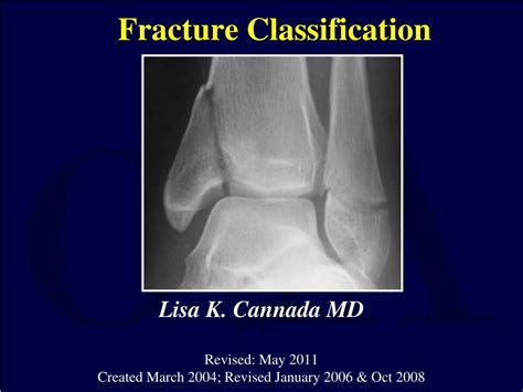 Ppt Fracture Classification Powerpoint Presentation Free Download