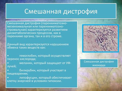 Дистрофии Причины развития дистрофии презентация онлайн