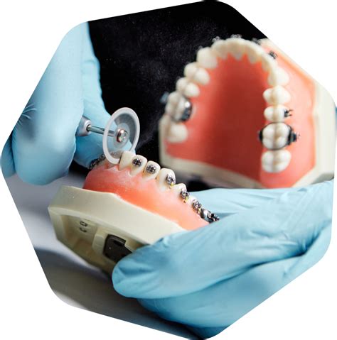 Clear Aligners IPR Workshop London Dental Institute