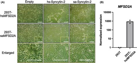 Comparison Of Cell Fusion Potential Of Syncytin‐2 In Mfsd2a