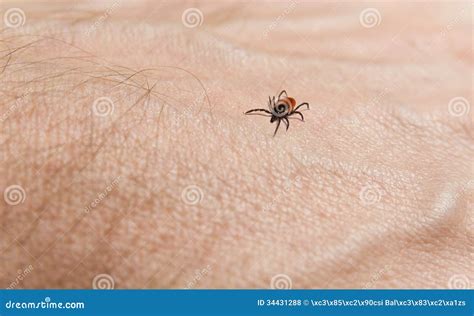 Black Legged Tick Ixodes Scapularis Aka Ixodes Dammini Royalty Free