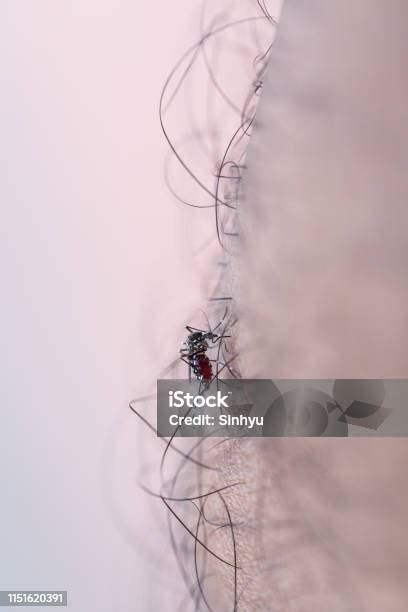 클로즈 업 애 데 아 이집트 티 인간의 피부에 일반적인 집 모기 혈액 인간을 빠는 애 들 이집트 티 가득 찬에 대한 스톡 사진