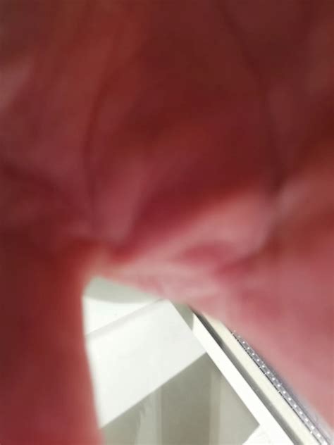 Dialator 28 Pics Xhamster