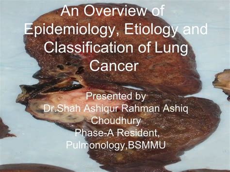 Lung Cancer Epidemiologyetiology And Classification Ppt