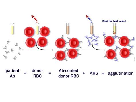 Immunologic Laboratory Tests