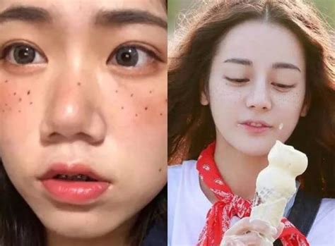 脸上麻子怎么消除麻子脸怎么治脸上长麻子大山谷图库