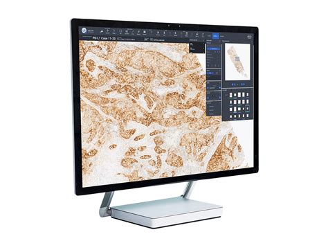 Ventana Pd L1 Sp263 Assays