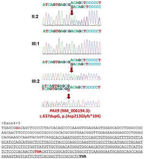Novel Pax9 Mutations Causing Isolated Oligodontia