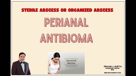 Perianal Antibioma Or Organized Abscess Youtube