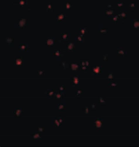 Ire1 Alpha Polyclonal Antibody Invitrogen™ 100 μg Unconjugated Ire1 Alpha Polyclonal Antibody