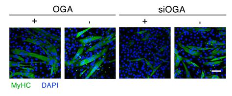 线粒体研究团队发现糖尿病中肌萎缩及其调控新机制 生命科学与技术学院