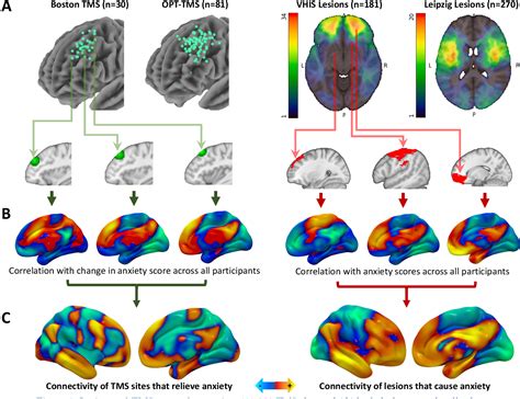 Figure 1 From Causal Network Localization Of Brain Stimulation Targets For Trait Anxiety