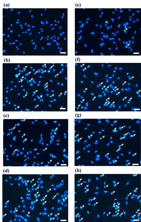 Detection Of Condensed Chromosomes And Fragmented Nuclei In Treated
