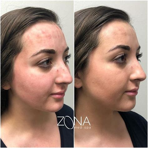 Пин на доске Before After Pictures