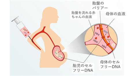 Nipt（新型出生前診断）はいくらかかる？診断にかかる費用を解説 東京・ミネルバクリニック
