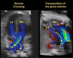 OB Midterm Flashcards Quizlet