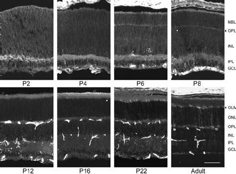 2 Expression During Mouse Postnatal Retinal Development No