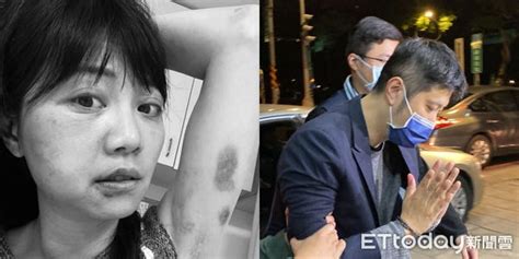 女绿委遭家暴 ，台独分子频为施暴男洗白被起底 香港法治报