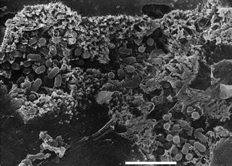 Localized Colony Of Epec O111 Mn B171 With A E Lesion Formation On Download Scientific