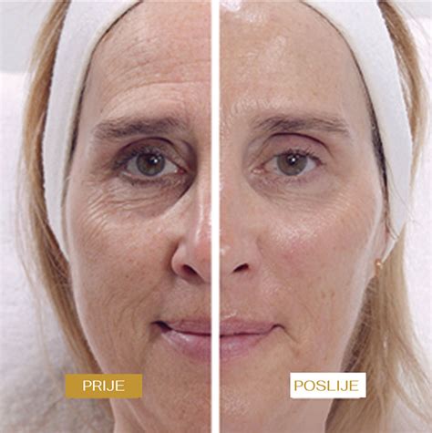 Guinot Visible Age Reverse Wellbis Portal