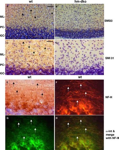 Presence Of Low Level Nf H And Nf M In The Parallel Fibers Of