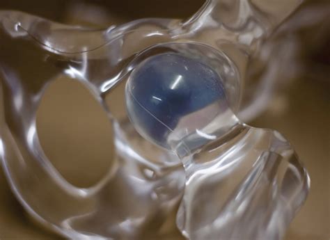 Joint Replacement Device Design Show 2017