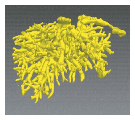 The Liver Vessel Segmented By Using The Improved Fuzzy Connectedness Download Scientific
