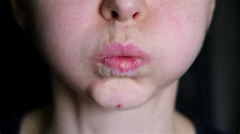 Close Up Of A Woman Puffing Out Her Cheeks Holding Her Breath And