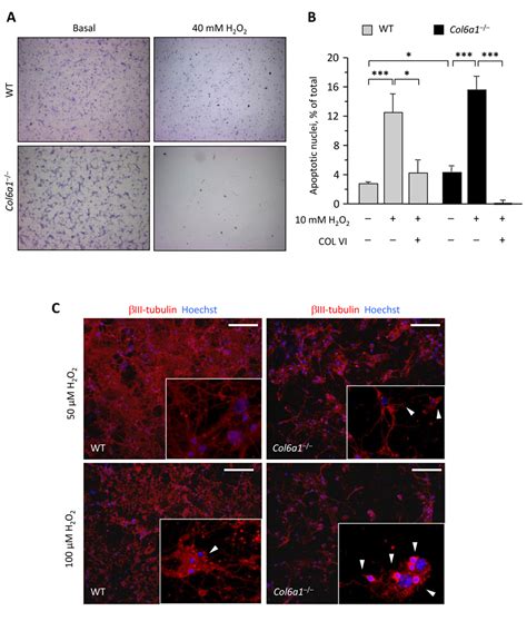 Lack Of Collagen Vi Promotes Neurodegeneration By Impairing Autophagy