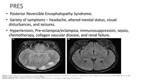 Encephalopathy Pptx