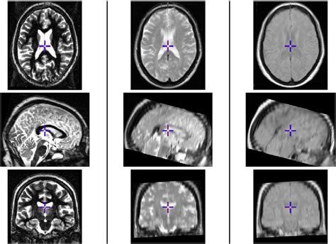 figure 1 from multi spectral brain tissue segmentation using automatically trained k nearest