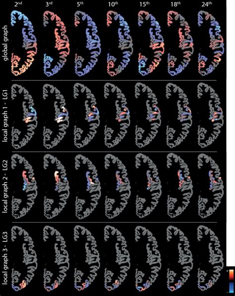 Figure From Characterization Of Brain Cortical Morphology Using Localized Topology Encoding