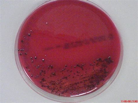 Porphyromonas Gingivalis Alchetron The Free Social Encyclopedia