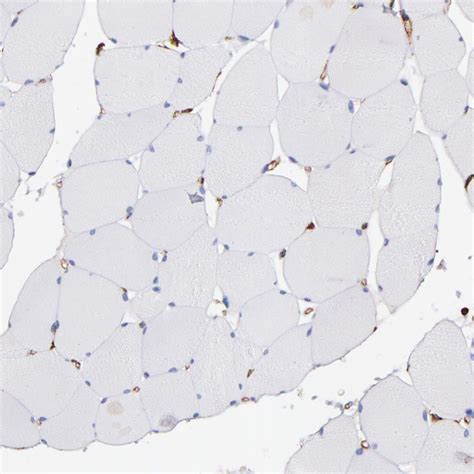 Anti Vim Antibody 100ul Unconjugated Rabbit Polyclonal Biozol