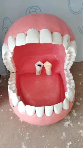 Fiberglass Reinforced Plastics Frp Products At Rs 3000 In Chennai