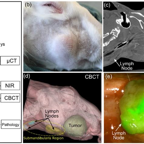 Surgical Guidance Using Intraoperative Nir Fluoresence Imaging In Head
