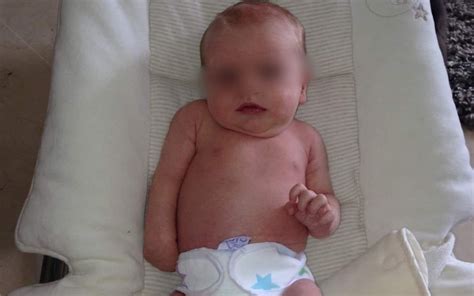 Paralizia De Plex Brahial Neurologie Pediatrica