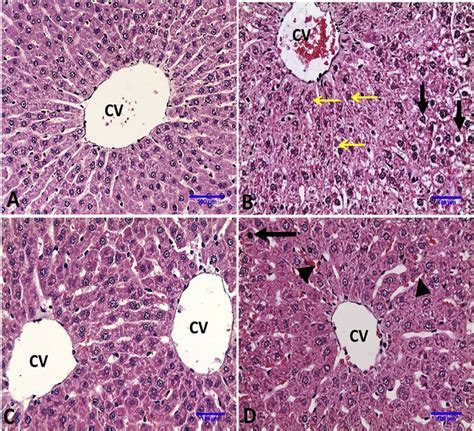 Representative Photomicrographs Of Liver Sections Of Rats In Different