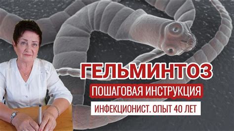 Гельминтоз: как избавиться от глистов без таблеток? Инструкция от ...