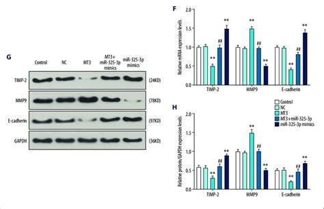 Mir 325 3p Regulated Proliferation Migration Invasion And Emt Via