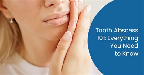 Tooth Abscess 101 Everything You Need To Know Bristol Dental
