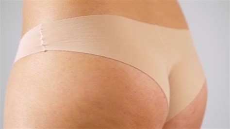Woman Compressing Skin Of The Buttocks And Checks For Stretch Marks And Cellulite 23157591 Stock