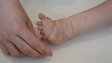 Congenital Finger Amputee Bondage Her Small Hand